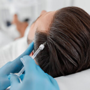 PRP For Hair Growth At Plush Aesthetic In Dlalas